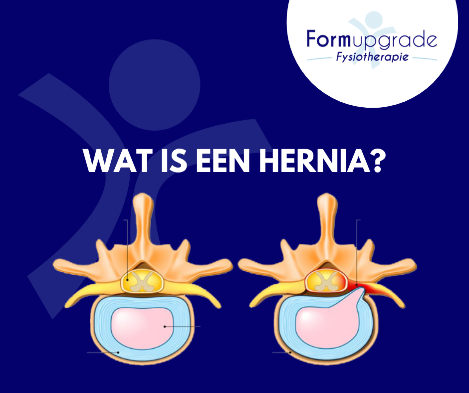 Nieuws / blog • Fysiotherapie Formupgrade